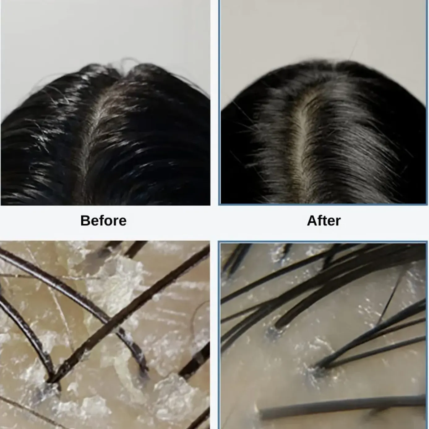 Liệu Pháp Tẩy Tế Bào Chết Da Đầu Với Muối Biển Growus Sea Salt Therapy ...